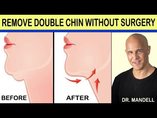 Tất cả những điều bạn cần biết về bài tập Mewing - nha khoa Thùy Anh ...