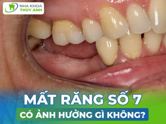 Missing tooth number 7: Causes, consequences and solutions