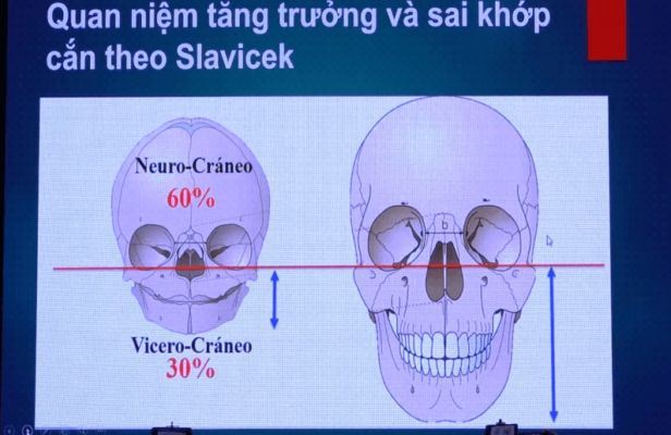 Sức mạnh của chỉnh nha không phẫu thuật với kỹ thuật Meaw, Geaw ...