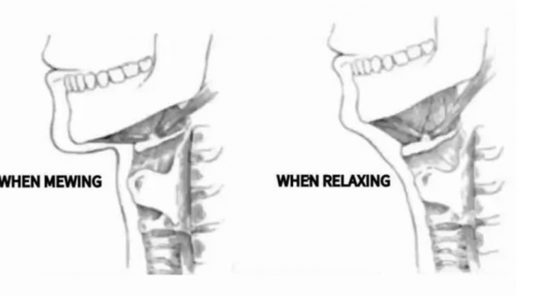 Kết quả tập mewing before after update nghiên cứu mới nhất