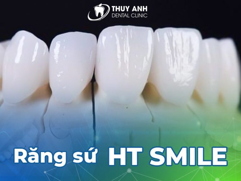 Răng sứ HT smile là gì? Ưu nhược điểm và chi phí