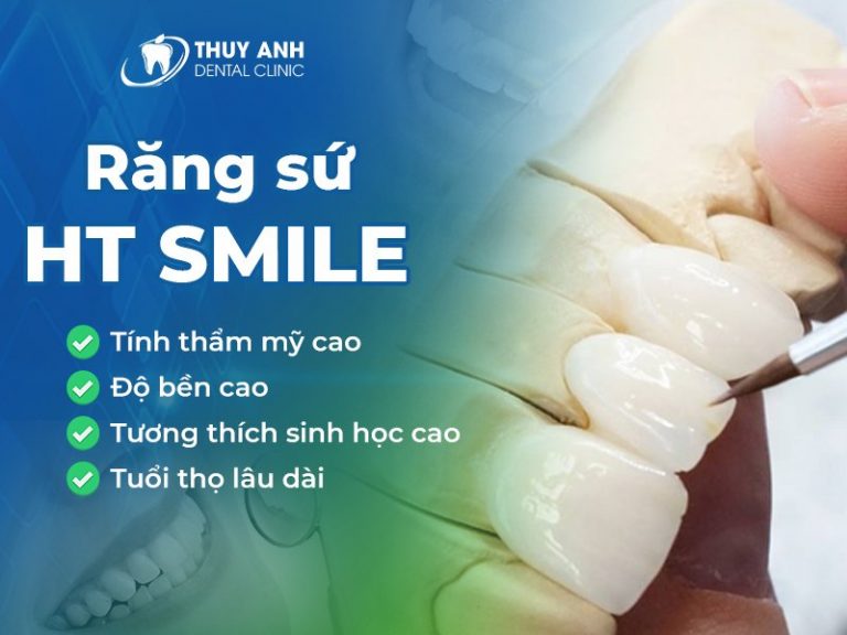 Răng sứ HT smile có mấy loại? Khi nào nên làm răng sứ HT smile?
