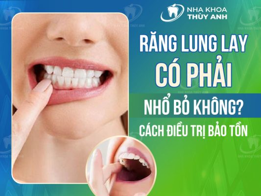 Lung lay răng có phải nhổ bỏ không? Cách điều trị bảo tồn - nhakhoathuyanh